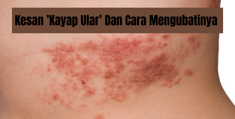 Kayap Ular Boleh Bawa Maut? Ini Penjelasannya