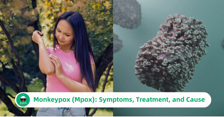 Monkeypox (Mpox): Symptoms, Treatment, and Cause